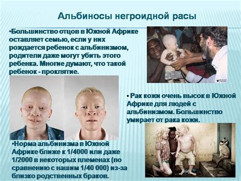 Альбинизм - Презентации по биологии