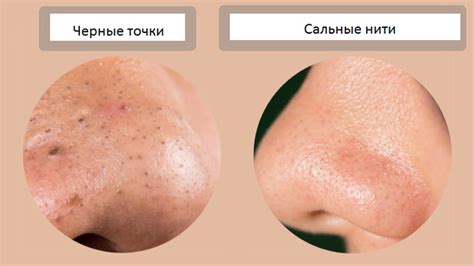 Средство с салициловой кислотой | Косметиста