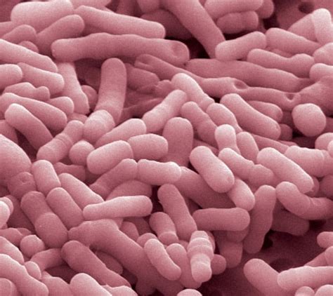 Bifidobacterium animalis - JCM 1190