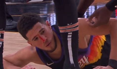 Did Patrick Beverley Intentionally Headbutt Devin Booker Head Leaving Him Bleeding and Almost ...