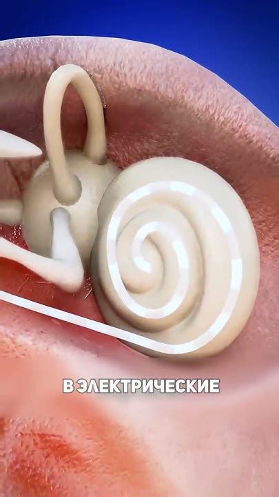 Как работает слуховой👂🏻аппарат #здоровье #уши #apple #наушники #аирподс ...