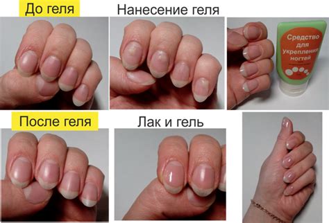 Как ускорить рост ногтей: средства и процедуры