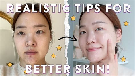 FINALLY NO ACNE😭 Realistic tips for glowing & healthy skin! - YouTube