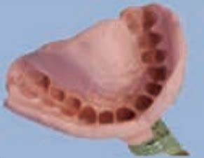 CharmTemp Crown – 덴키스트