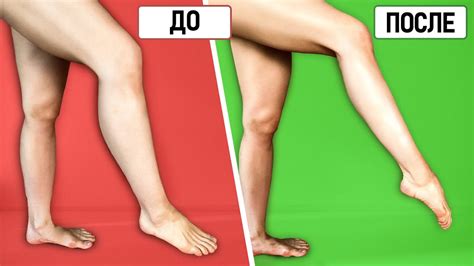 Убираем ОТЕКИ и ЛИШНЮЮ ВОДУ💦 Лучшие УПРАЖНЕНИЯ для разгона лимфы и ...