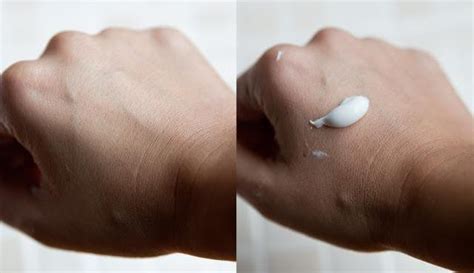Крем Cicaplast Baume B5: инструкция по применению и отзывы :: SYL.ru