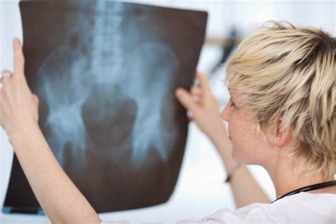 Перелом копчика симптомы, перелом копчика | MedAboutMe