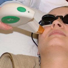 Laser Acne Removal | Akne narben, Akne, Hausgemachte gesichtsmasken