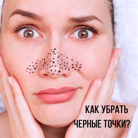 Как убрать черные точки на лице 2020 | ВКонтакте