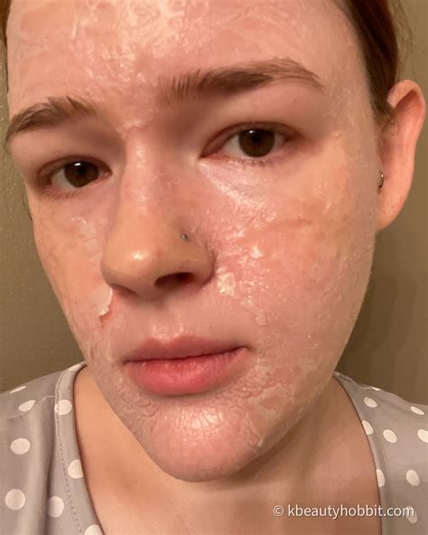 SKIN1004 Zombie Pack Review