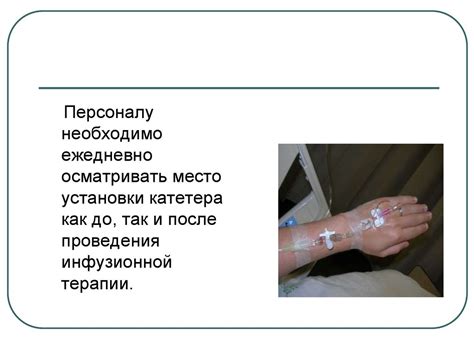 Периферический внутривенный катетер - презентация онлайн