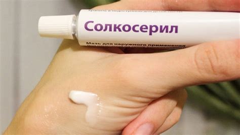Рейтинг ТОП 7 лучших средств от ожогов: какое выбрать