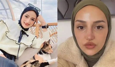 Amin diyen kız estetik mi yaptırdı? (YENİ HALİ) Amin diyen kızın yüzüne ...