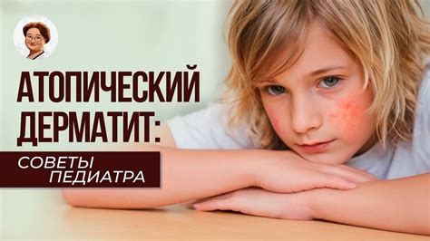 Атопический дерматит у детей. Симптомы, лечение, уход за кожей. - YouTube