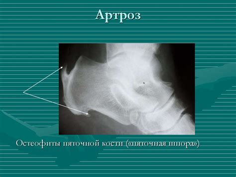 Лучевое исследование костей и суставов - online presentation
