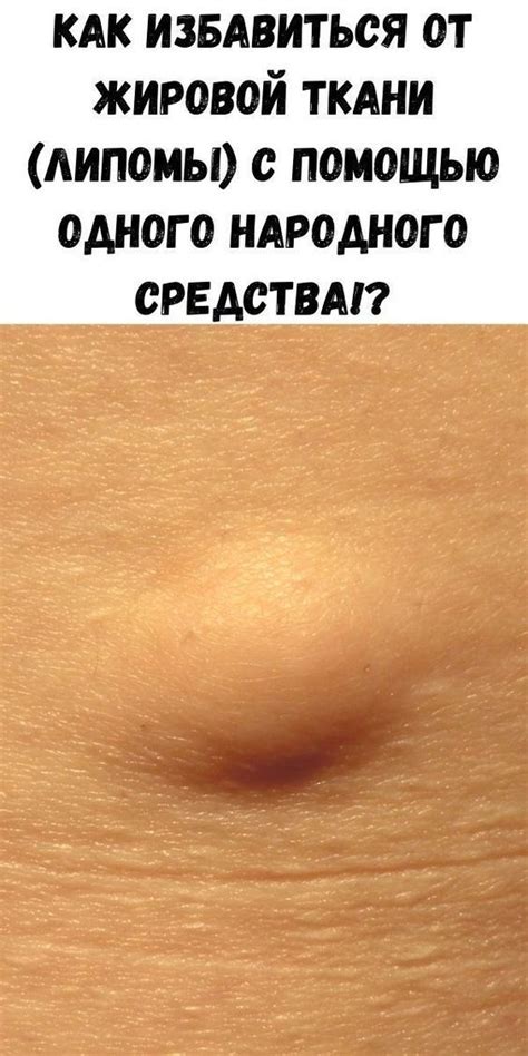 Как избавиться от жировой ткани липомы с помощью одного народного ...