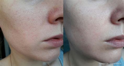 Профессиональный салонный уход в домашних условиях со средствами BTpeel ...
