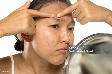 Young Asian Woman Squeezing Pimple Stock Photo - Download Image Now ...