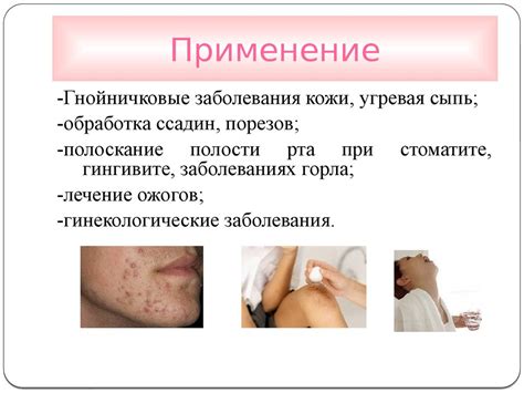Антисептики и дезинфицирующие средства. (Лекция 6) - презентация онлайн