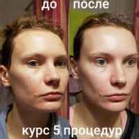 Пилинг-гель ARAVIA ANY-Time Control | отзывы