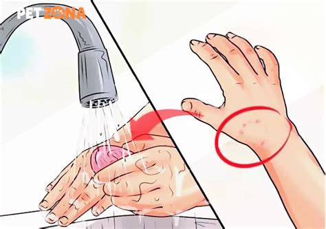 Как действовать, если собака укусила: первая помощь и профилактика