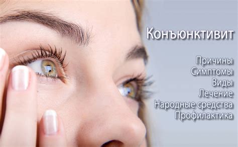 Лечение конъюнктивита: причины и симптомы, виды, профилактика