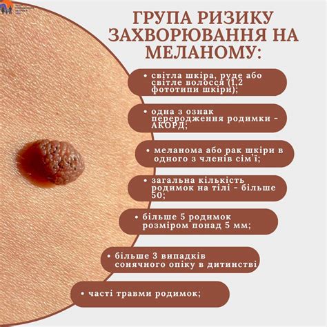 Меланома - Балтський центр ПМСД