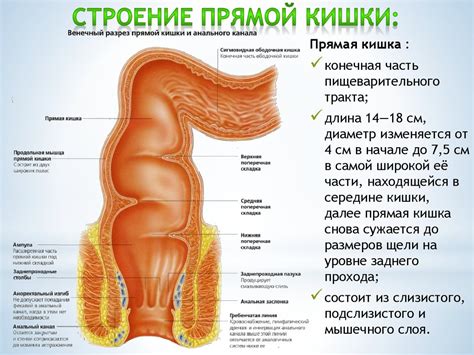 Профилактика заболеваний прямой кишки - презентация онлайн