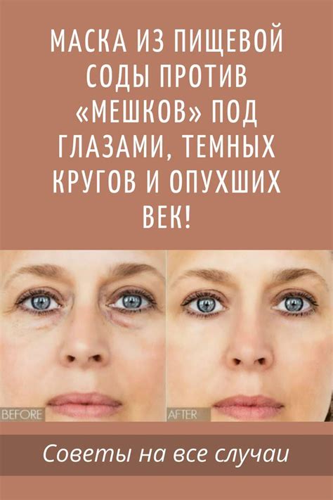 Маска из пищевой соды против «мешков» под глазами, темных кругов и ...