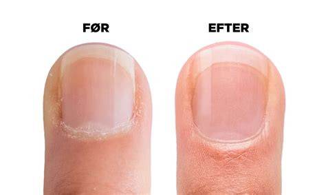 Cuticle Eraser, CND Essentials - Insight Cosmetics