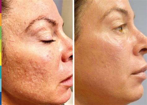 DERMAQUEST » Виды ретинола в косметике| Статьи | Отзывы | Купить