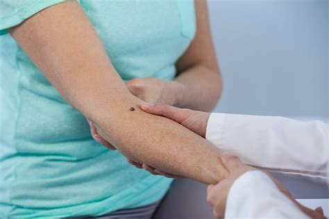 Простое средство от висячих родинок / Будьте здоровы