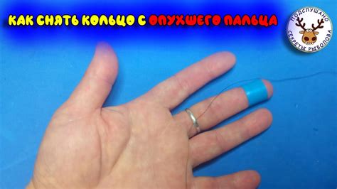 Как снять кольцо с пальца, если он распух 👍 Не думал, что это так ...