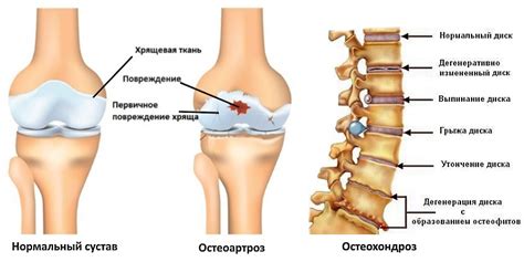 Драстоп. Инструкция и показания по применению. Цена. Аналоги. Отзывы