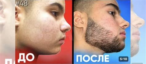 Средство для роста бороды и волос Minoxidil 15 купить в Санкт ...