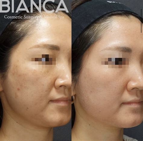 The power of ZOSKIN therapeutic!! ️ | Japan's leading beauty, health ...