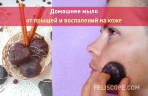 Домашнее мыло от прыщей и воспалений на коже