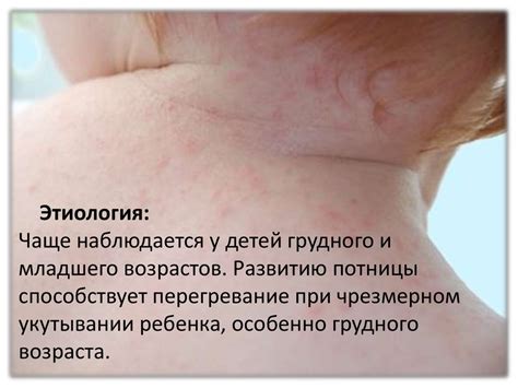 Неинфекционные заболевания кожных покровов - презентация онлайн