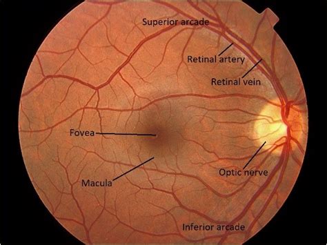 Moran CORE | Retina & RPE Histopathology