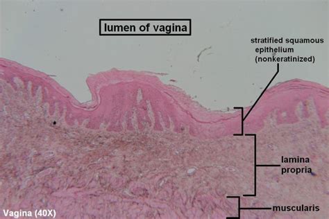 Vagina – Tutorial – Histology Atlas for Anatomy and Physiology