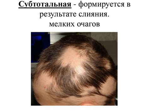 Патология волос и кожи волосистой части головы - online presentation