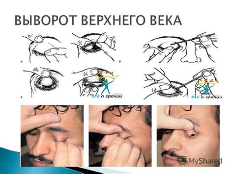 Презентация на тему: "Пихтулова О.В.. центральное зрение периферическое ...