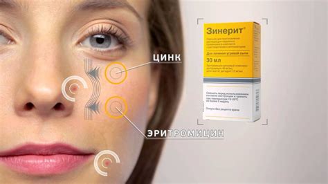 Цинковая мазь от прыщей и постакне на лице: инструкция по применению ...
