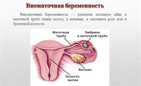 Негормональные противозачаточные таблетки нового поколения