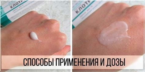 Клотримазол мазь: инструкция по применению для взрослых и детей, состав ...