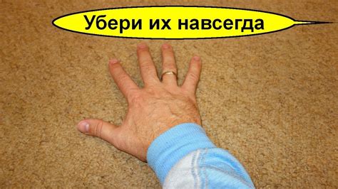 Безопасное народное средство как избавиться от папиллом в домашних ...