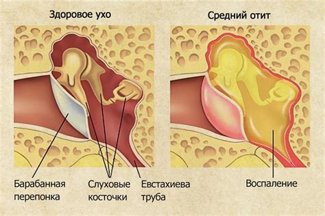Боль в ухе при глотании - причины и лечение