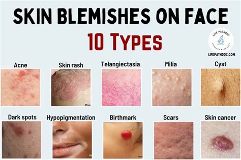 10 Types of Skin Blemishes on Face & How to Get Rid of Them