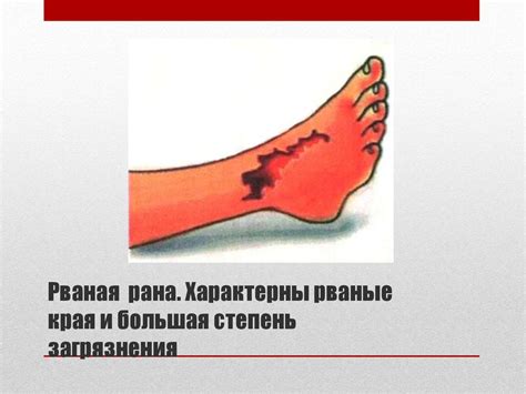 Раны, кровотечения. Первая помощь - презентация онлайн