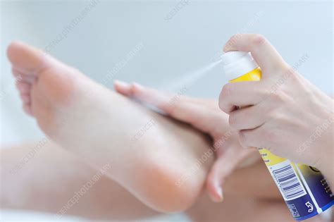 Footcare - Stock Image - C033/0393 - Science Photo Library
